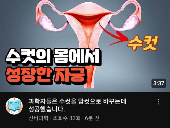 TS 수술 현실 눈앞으로 다가와.. | 유머 게시판 | RULIWEB